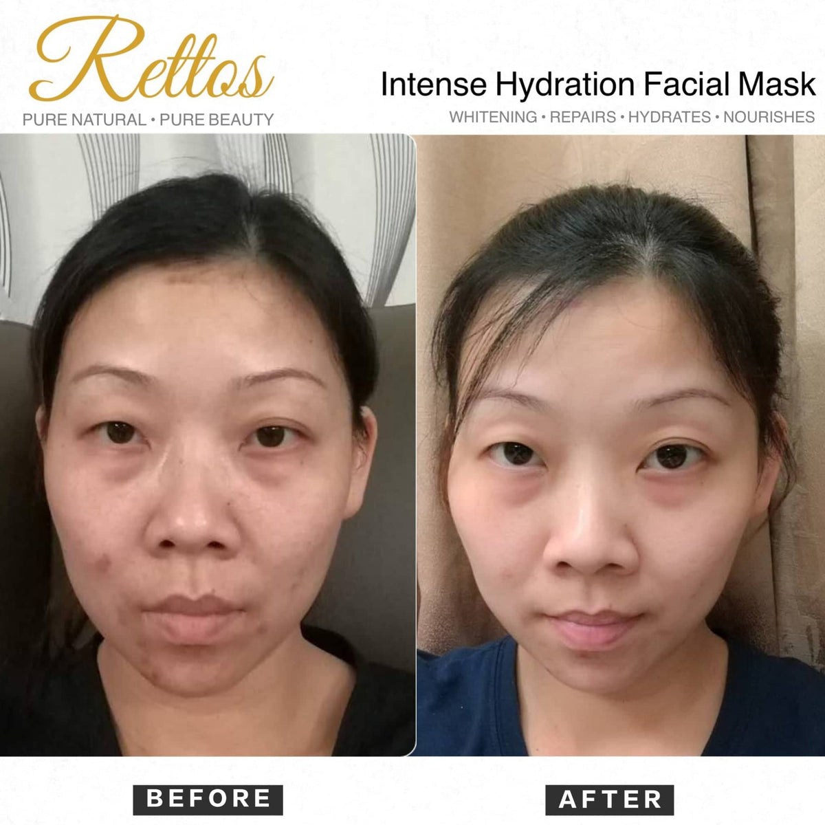 INTENSE HYDRATION FACIAL MASK – RETTOS